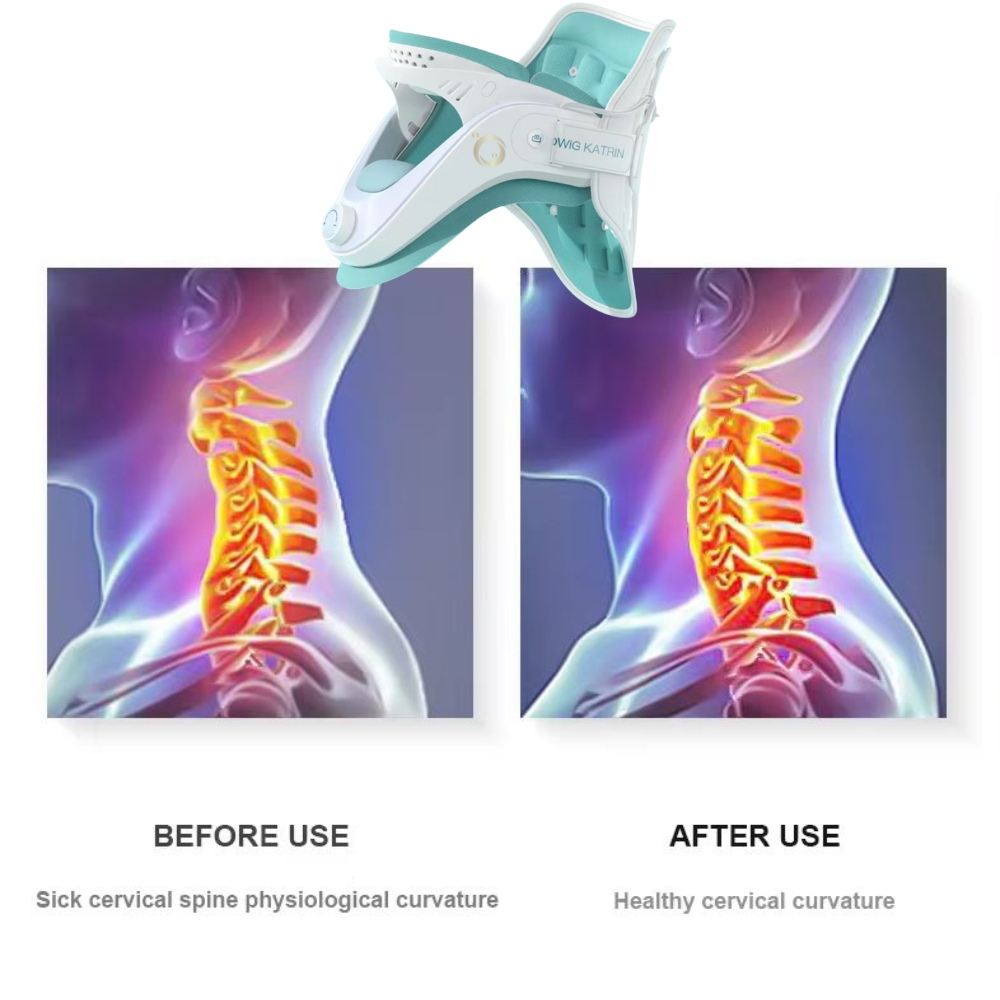 Guler Cervical pentru Spondiloza si Hernie Cervicala